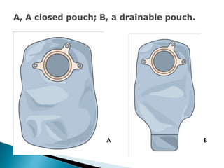 alternationsinbowelelimination-190624040214.pdf