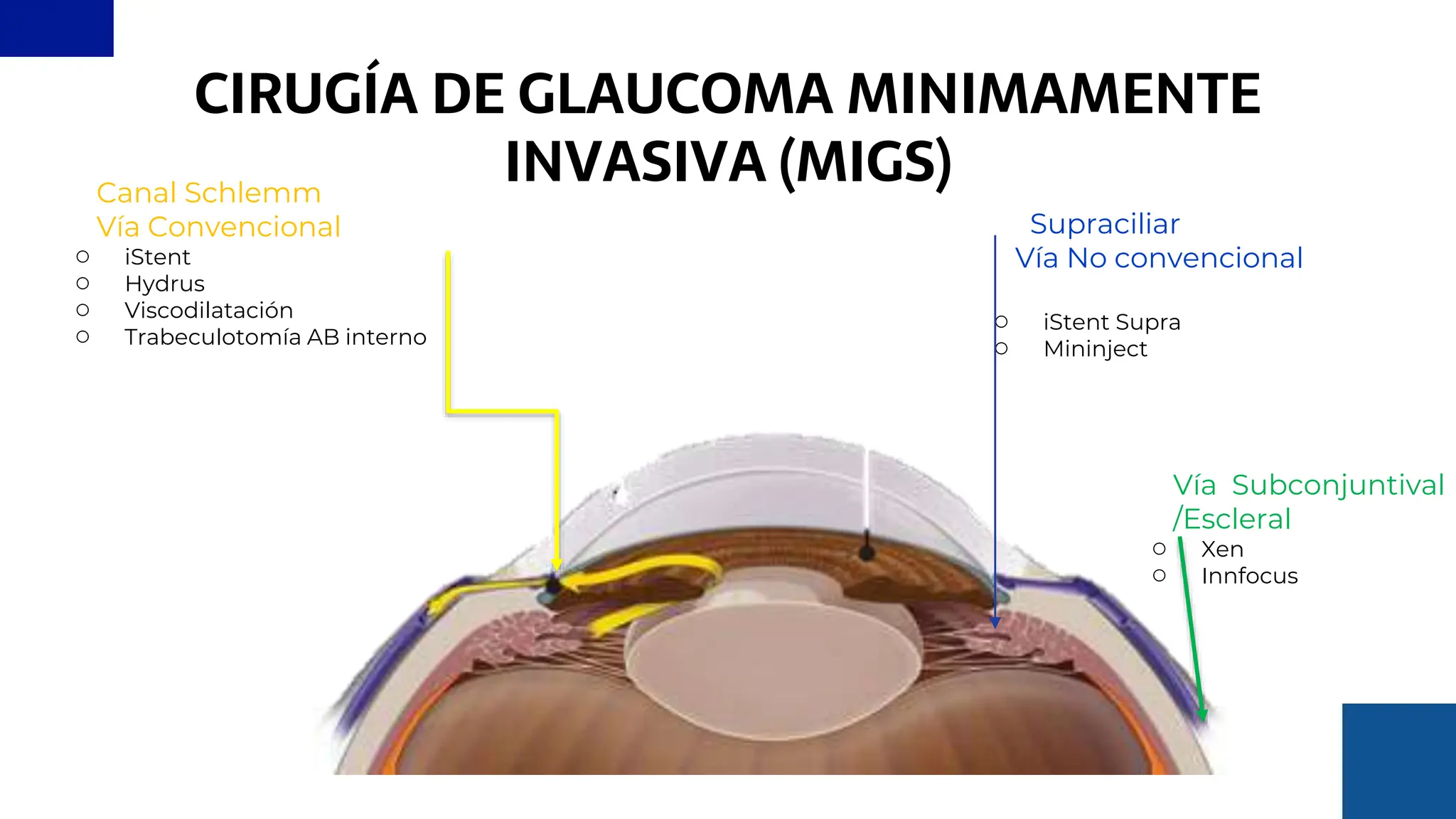 ALTERNATIVAS DE MANEJO EN EL GLAUCOMA PRIMARIO DE ANGULO ABIERTO .pptx