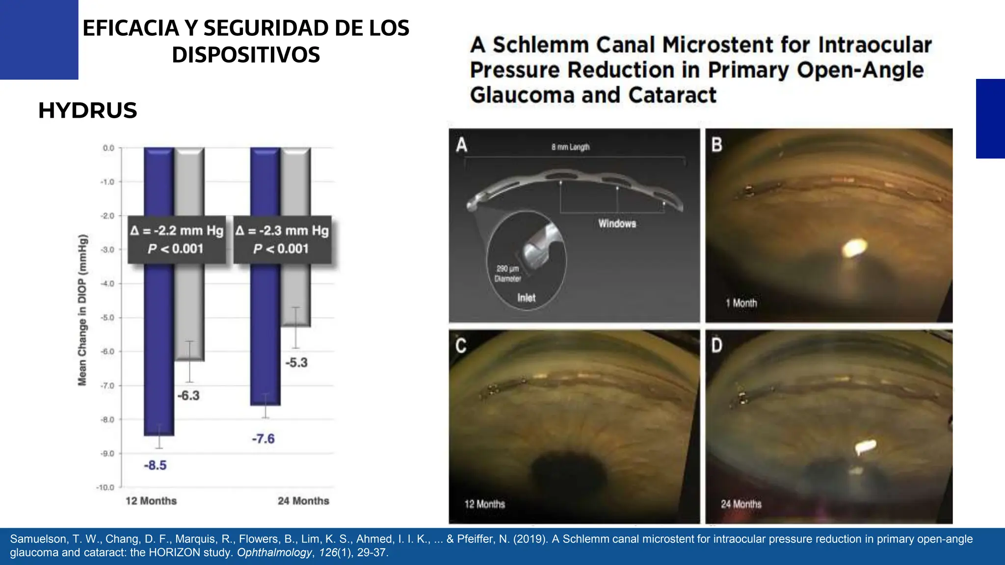 ALTERNATIVAS DE MANEJO EN EL GLAUCOMA PRIMARIO DE ANGULO ABIERTO .pptx