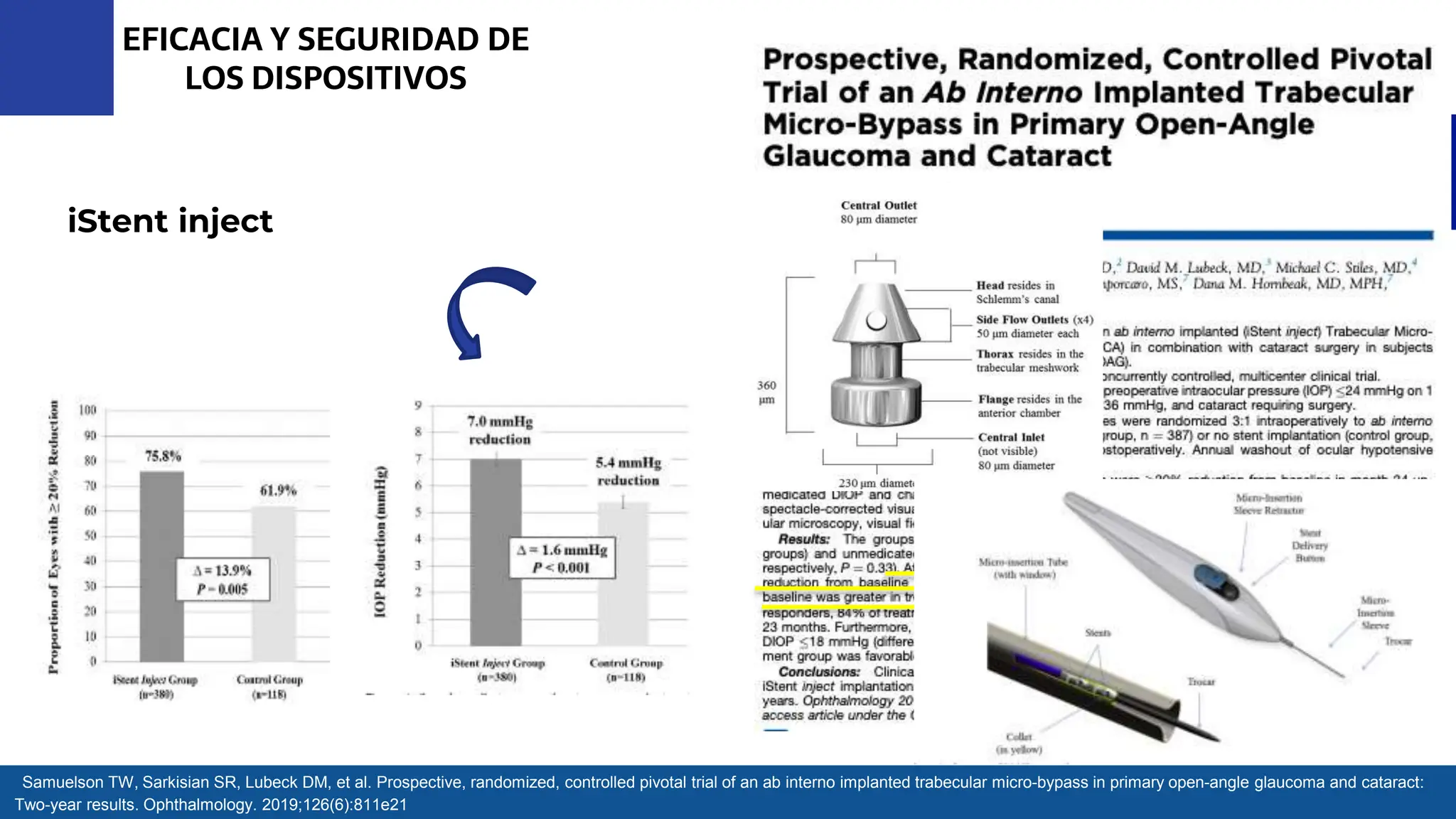 ALTERNATIVAS DE MANEJO EN EL GLAUCOMA PRIMARIO DE ANGULO ABIERTO .pptx