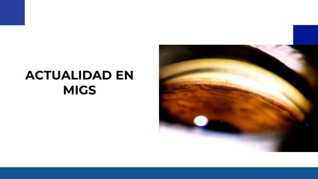 ALTERNATIVAS DE MANEJO EN EL GLAUCOMA PRIMARIO DE ANGULO ABIERTO .pptx