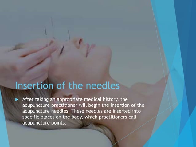 Acupuncture | PPT