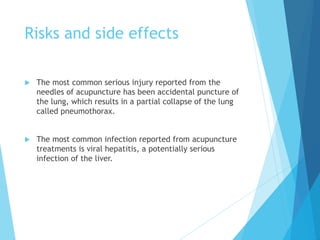 Acupuncture | PPTX