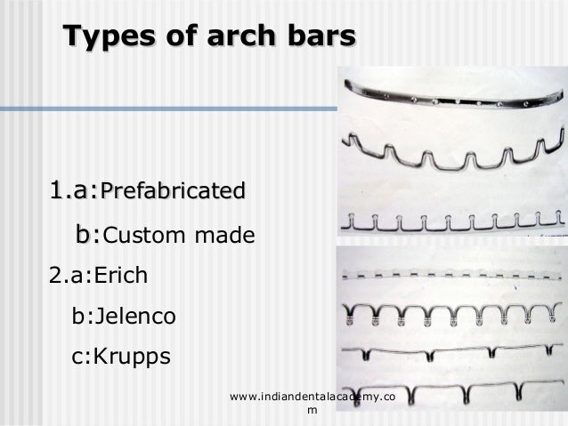 Alternative methods of fixation /dental courses