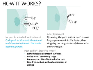 alternatives to conventional cavity preparation.ppt