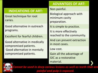 Alternatives to conventional cavity preparation in paedodontics | PPTX