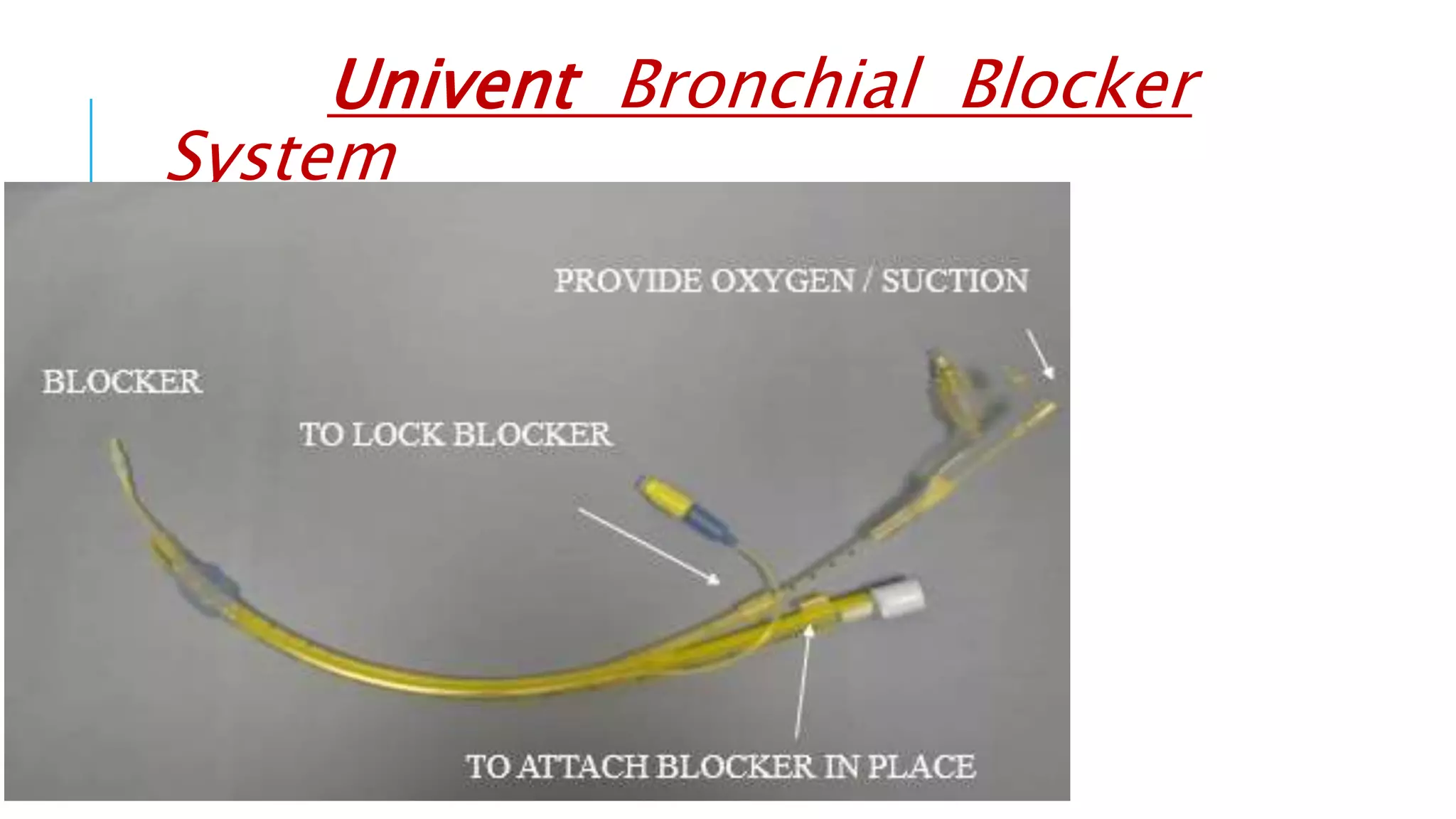 ALTERNATIVES TO double lumen tubes IN ONE LUNG VENTILATION.pptx