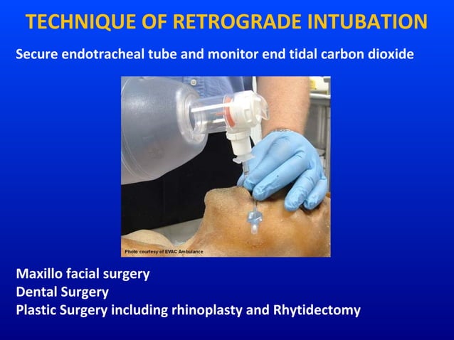 Alternative technique of intubation retromolar, retrograde, submental ...