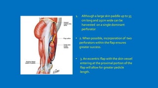 altflap presentation.pptx