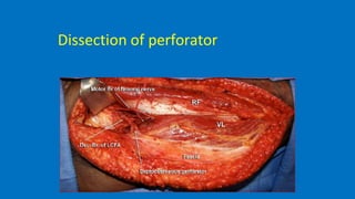 altflap presentation.pptx