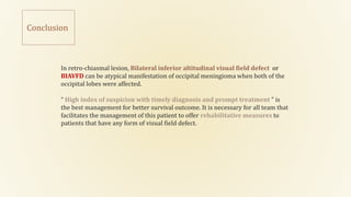 Altitudinal Visual Field Defect.pptx