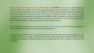 Altitudinal Visual Field Defect.pptx