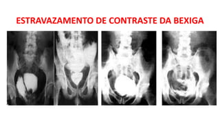 Alula contrastado urografia e uretrocistografia | PPTX