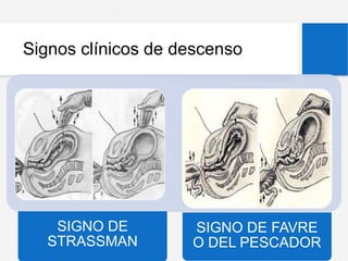 Alumbramiento y hemorragia postparto | PPTX