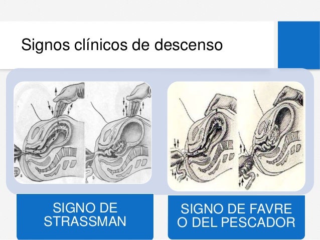 Alumbramiento y hemorragia postparto