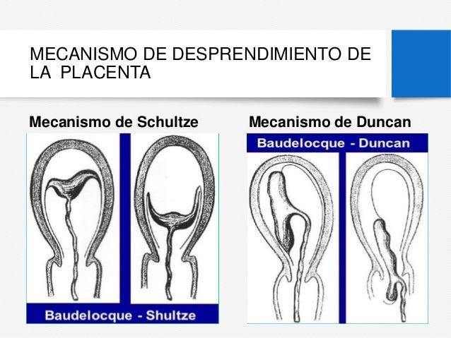 Alumbramiento y hemorragia postparto