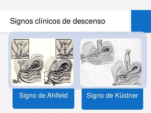 Alumbramiento y hemorragia postparto