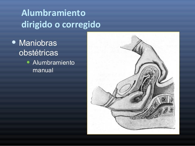 Alumbramiento normal