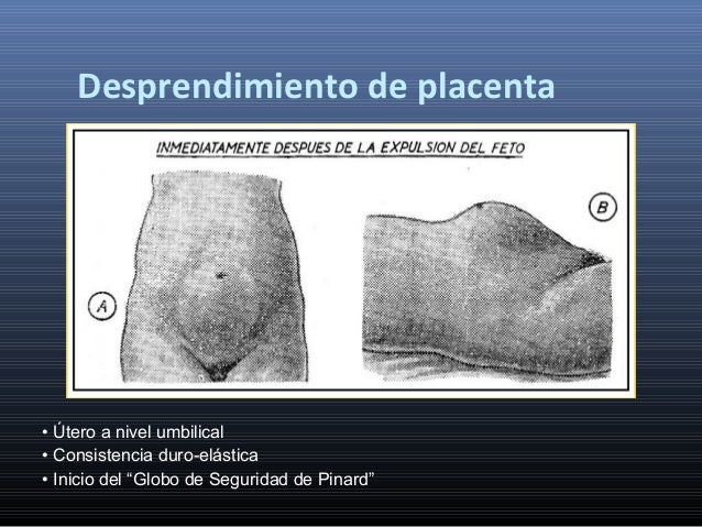 Alumbramiento normal