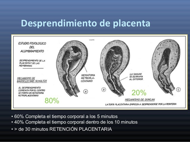 Alumbramiento normal