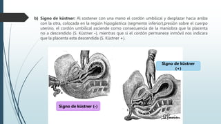 alumbramiento normal.pptx