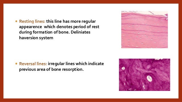 AlVEOLAR BONE dr naveen reddy