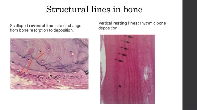 Oral Histology - Alvelor bone