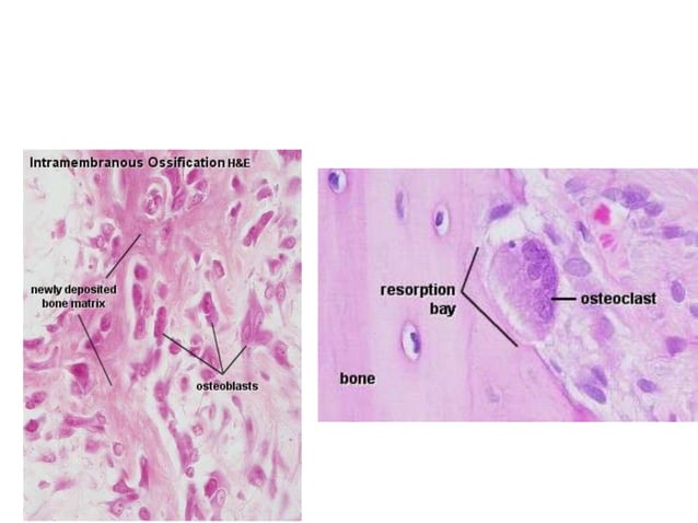Alveolar | PPT