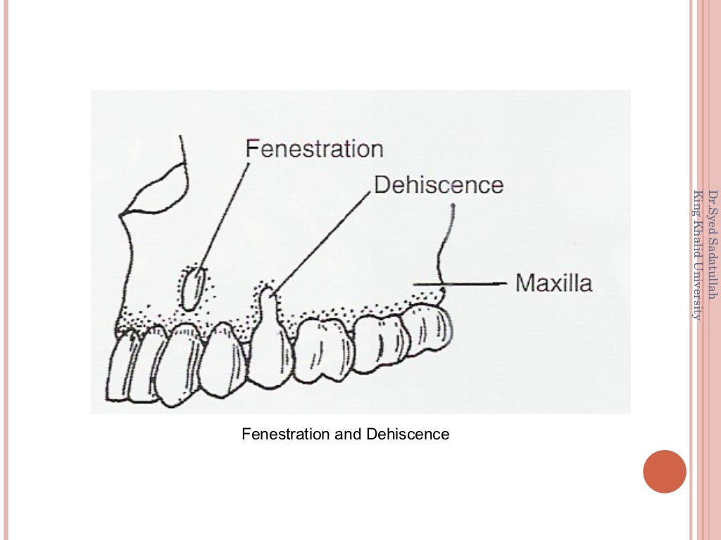 Alveolar Bone