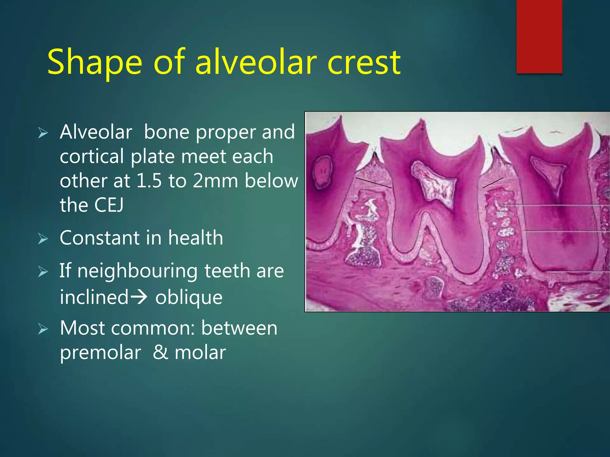 Alveolar bone | PPTX