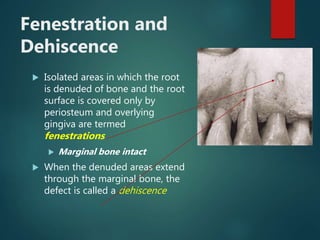 Alveolar bone | PPTX