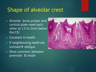 Alveolar bone | PPT