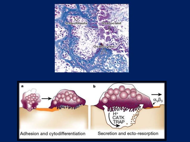 Alveolar bone | PPTX | Bone and Joint Conditions | Diseases and Conditions