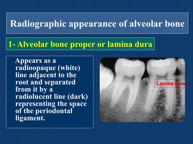 Alveolar bone | PPT