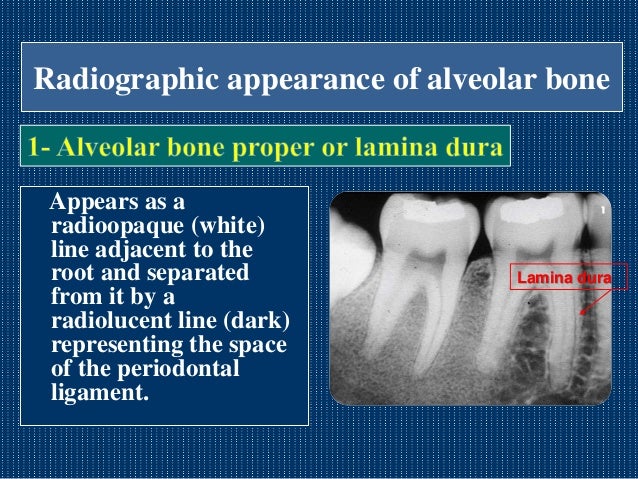 Alveolar bone