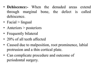 Alveolar bone | PPTX