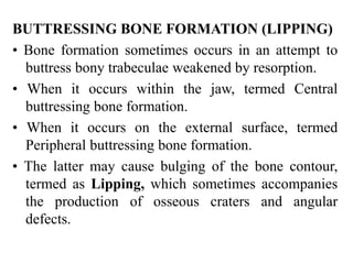 Alveolar bone | PPTX