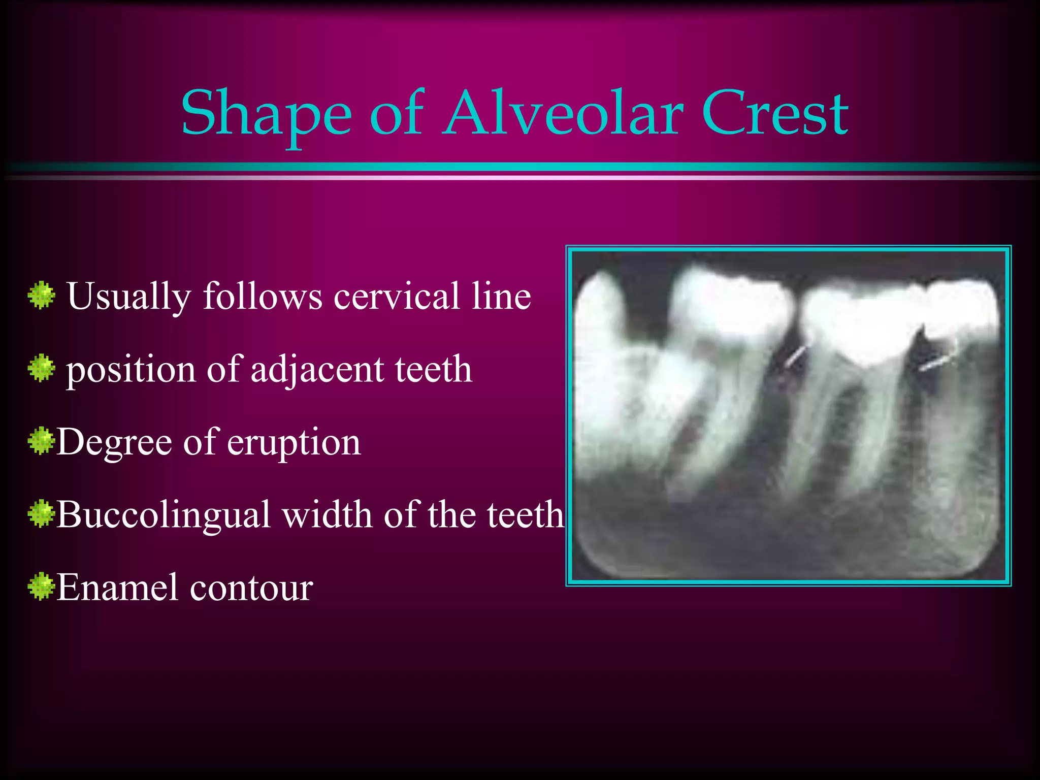 Alveolar Bone.ppt