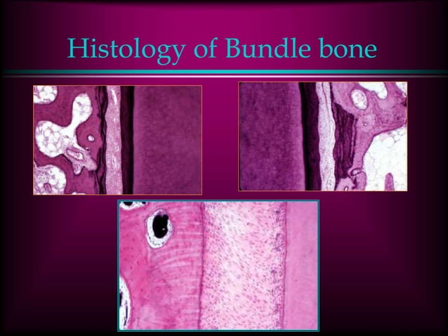Alveolar Bone.ppt | Bone and Joint Conditions | Diseases and Conditions