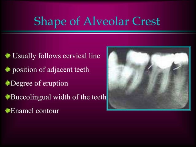 Alveolar Bone.ppt | Bone and Joint Conditions | Diseases and Conditions