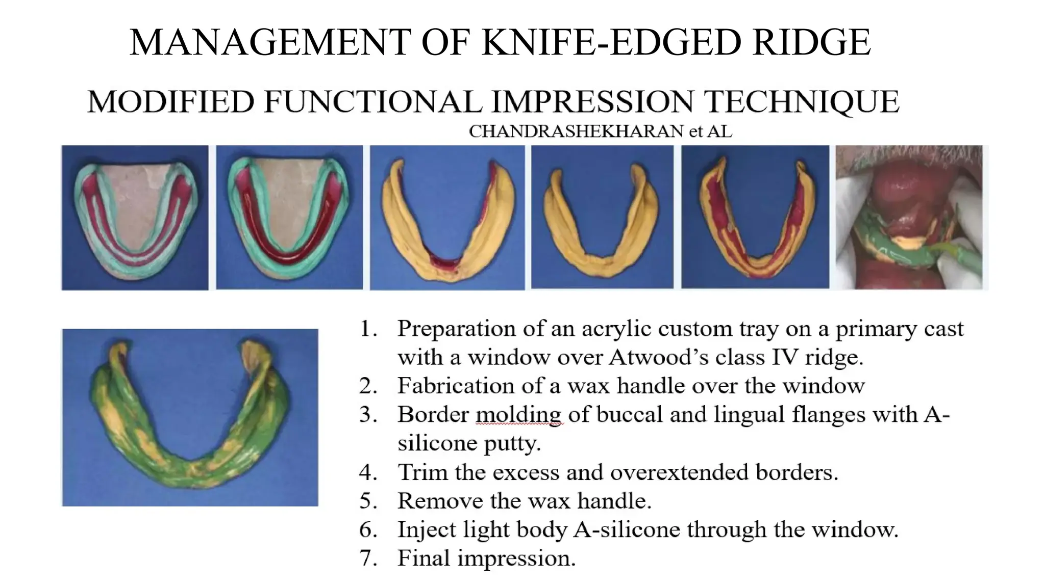 ALVEOLAR BONE and residual ridge resorption.pptx