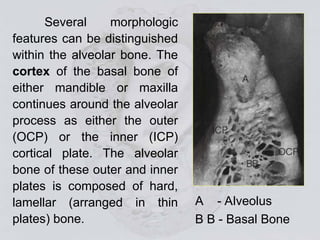 Alveolar Bone basic terminologies and concept.ppt