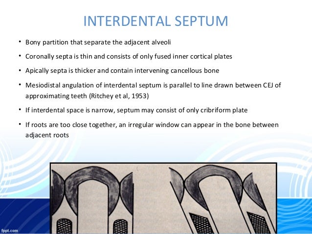 Interradicular Septum