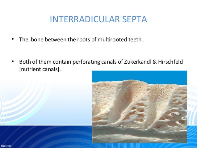Interradicular Bone