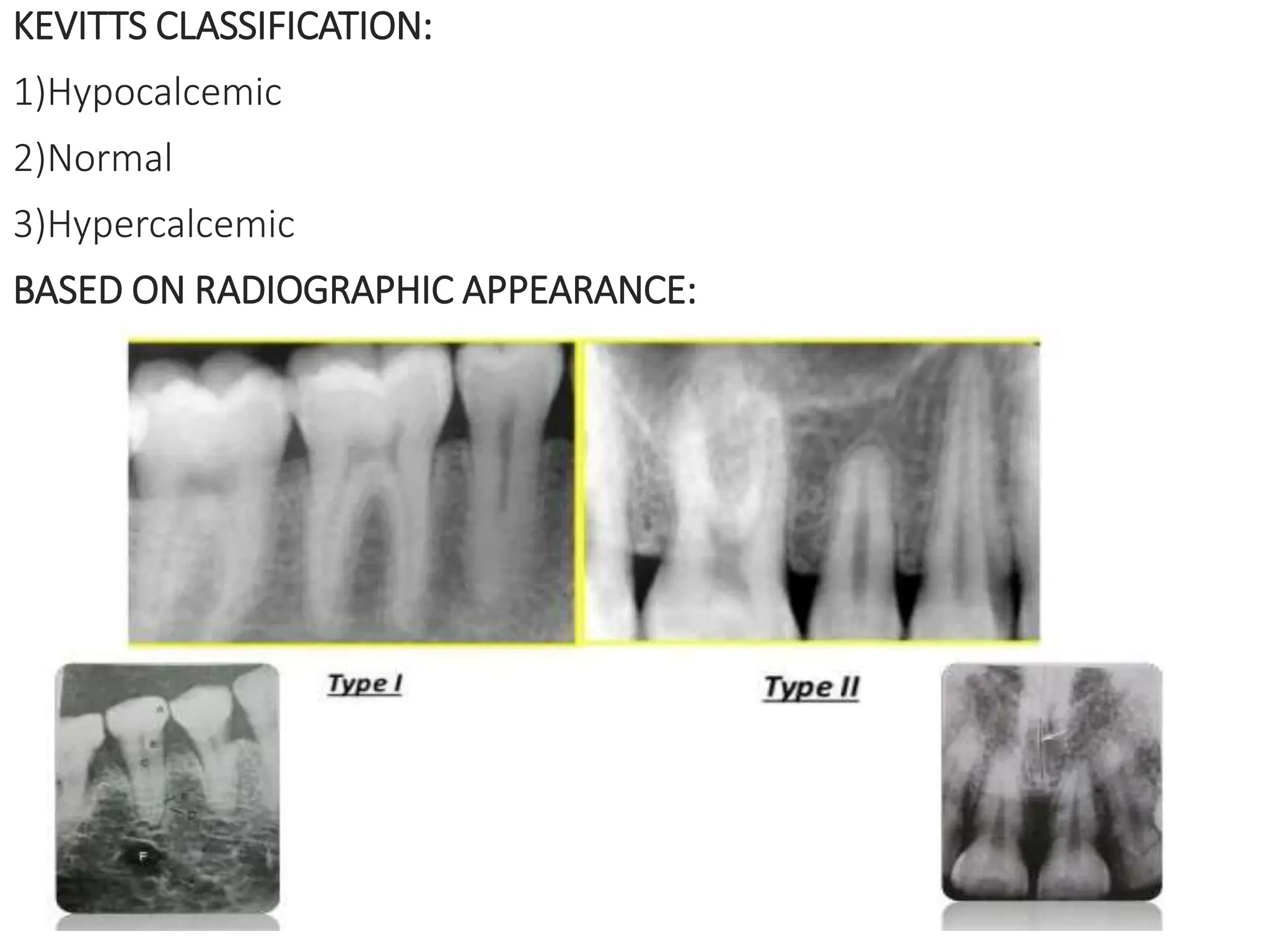 ALVEOLAR BONE IN HEALTH AND DISEASE [Autosaved].ppt