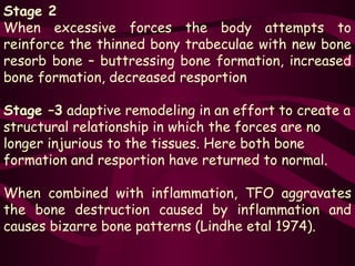 Alveolar bone in perio disease.pptAlveolar bone in perio disease.ppt