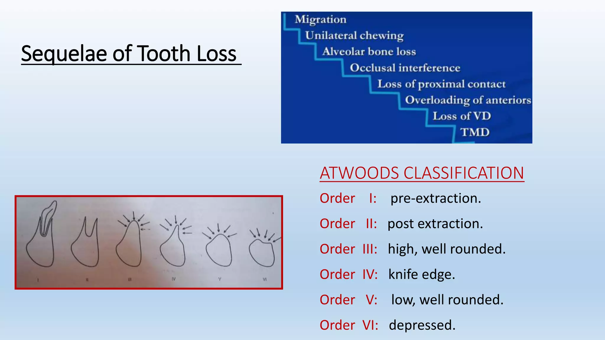 Alveolar bone in prosthodontics | PPTX