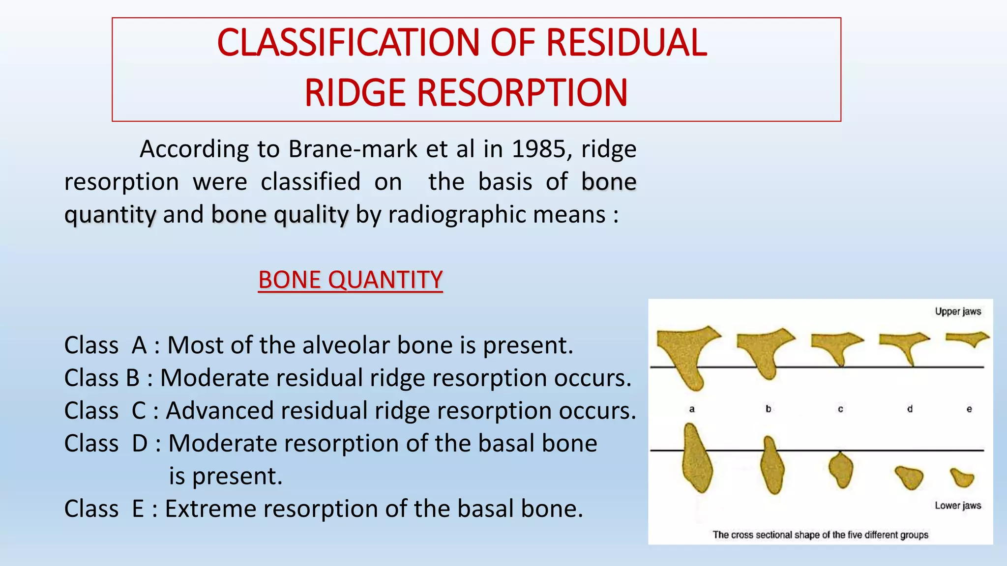 Alveolar bone in prosthodontics | PPTX