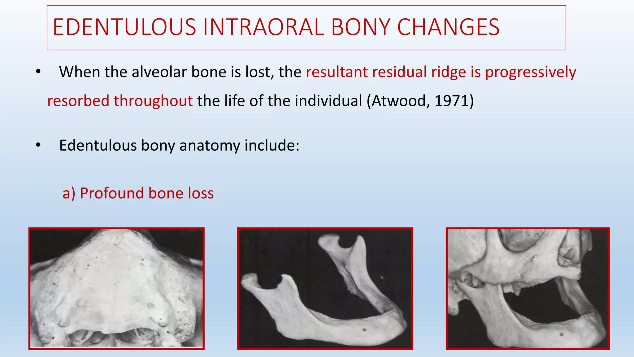 Alveolar bone in prosthodontics | PPTX