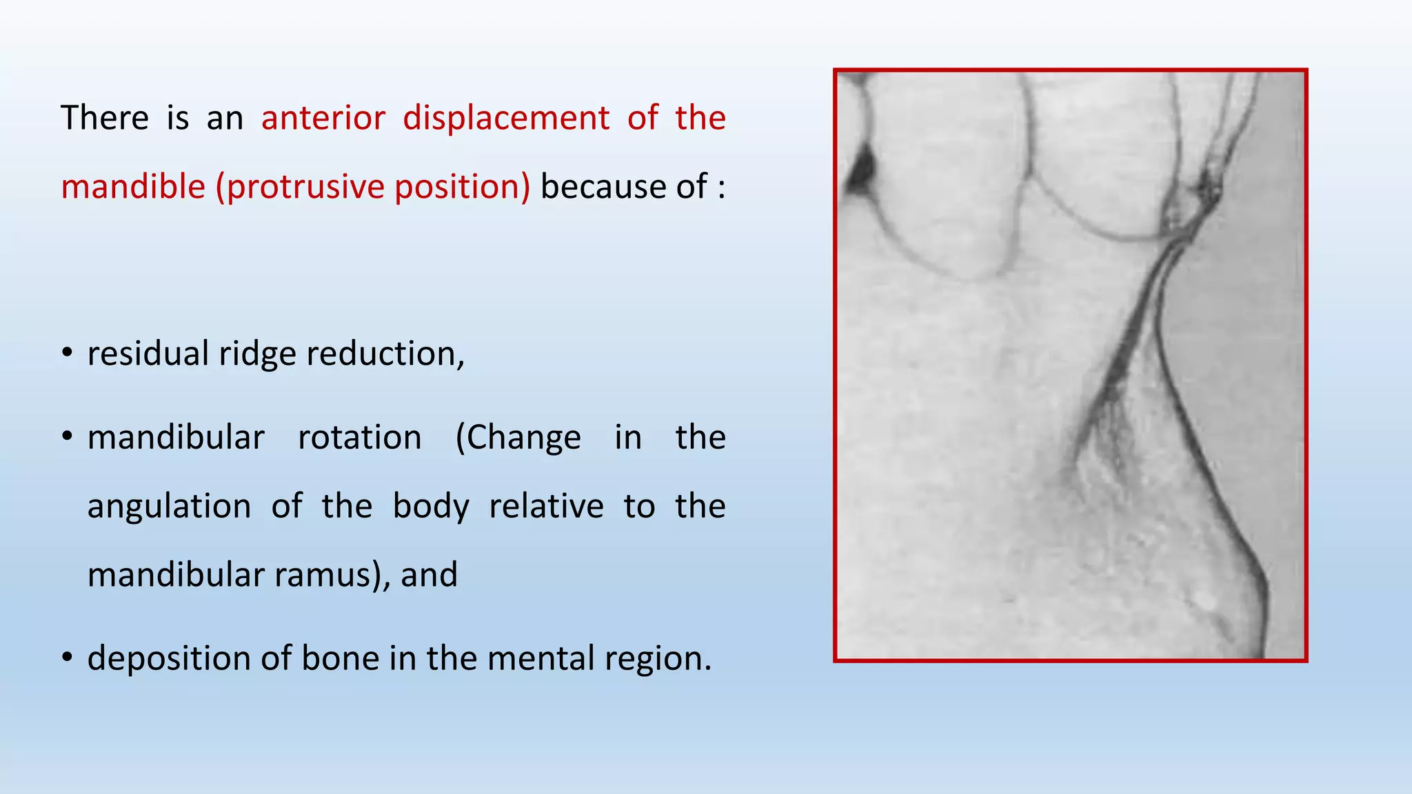 Alveolar bone in prosthodontics | PPTX